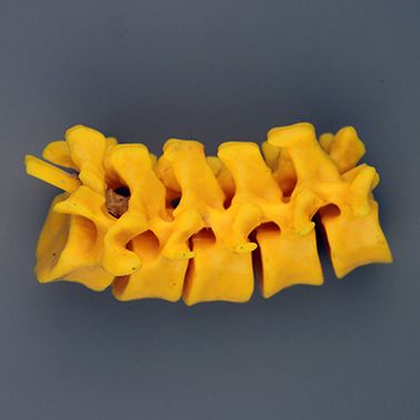 3D Printable Lumbar Vertebrae by Annalize Butler