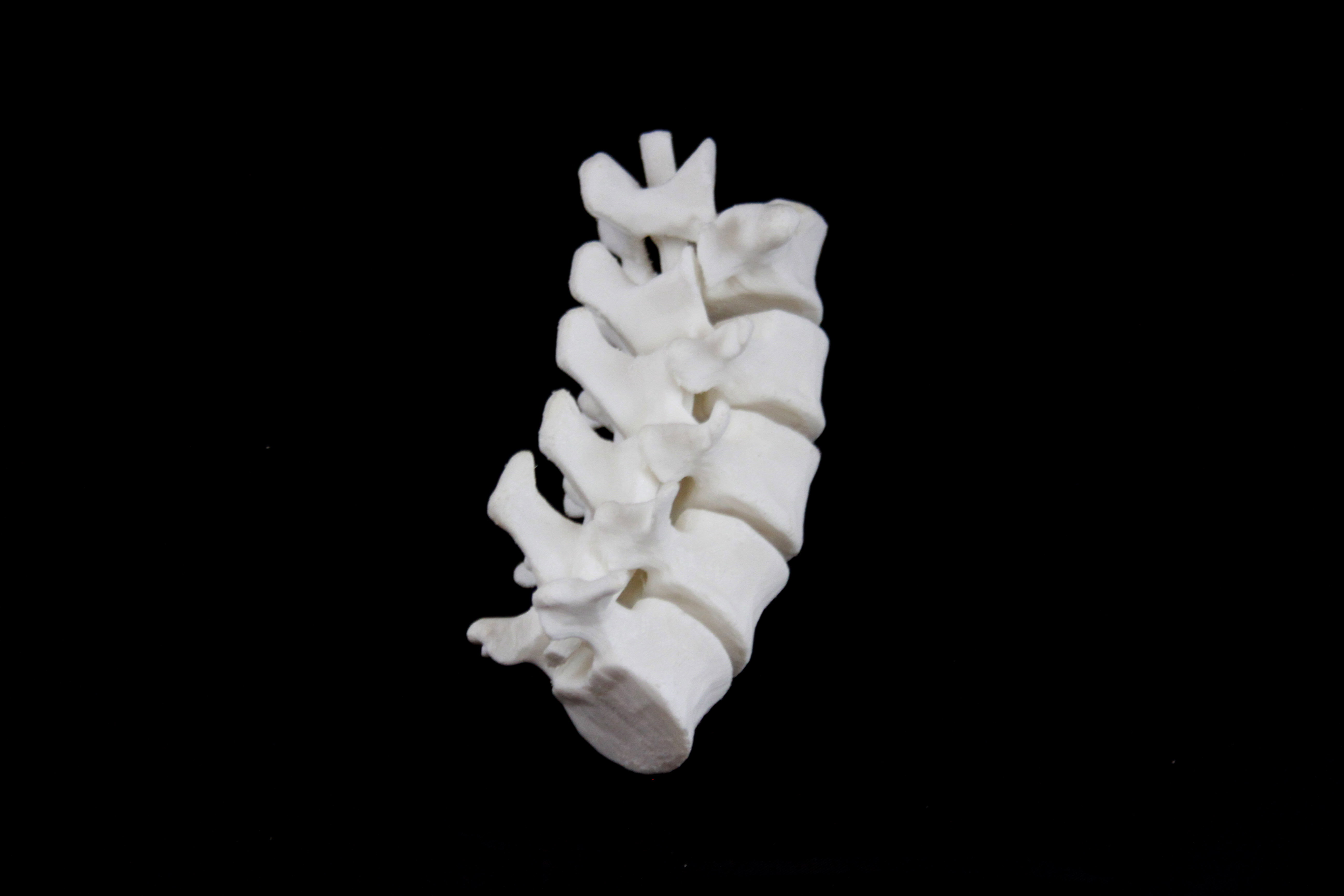 3D Printable Lumbar Vertebrae by Annalize Butler