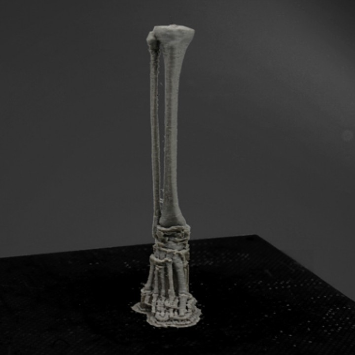 3D Printable Skeleton Leg by Annalize Butler