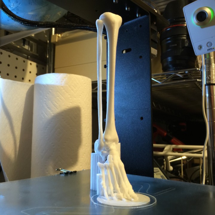 3D Print of Skeleton Leg by 3DNrj