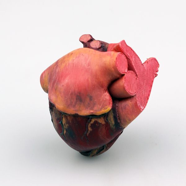 3D Printable Anatomical Heart by Drew Morgan