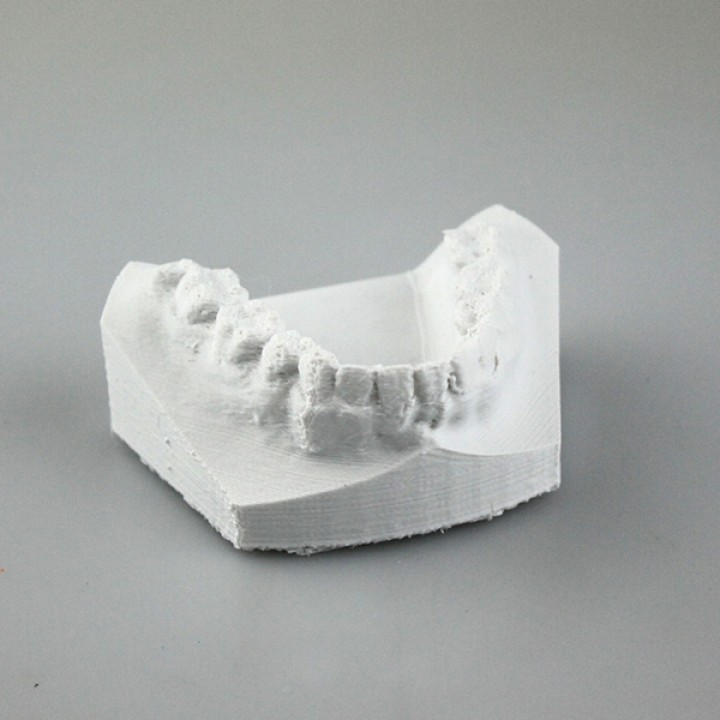3D Printable Teeth by YU-TA Chen