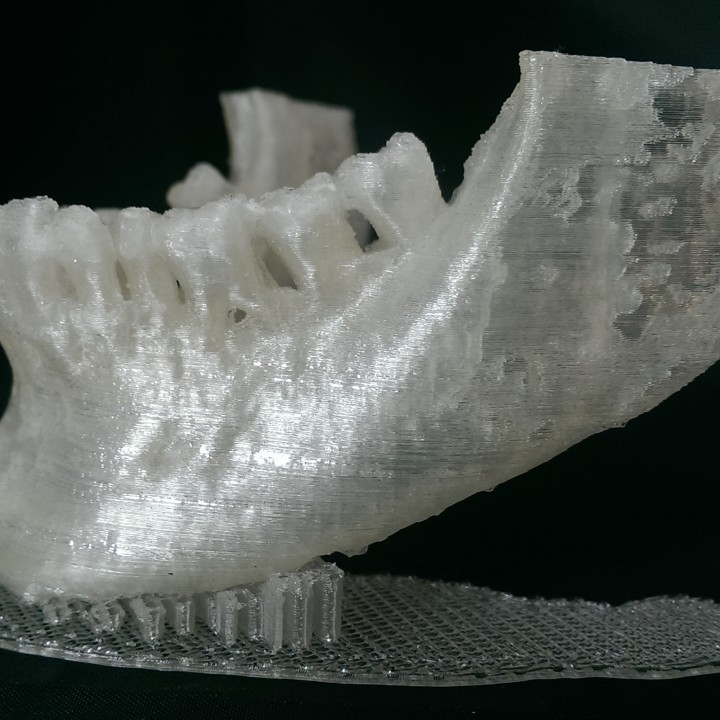 3D Printable Mandibula from file DICOM by Gabriele Poma