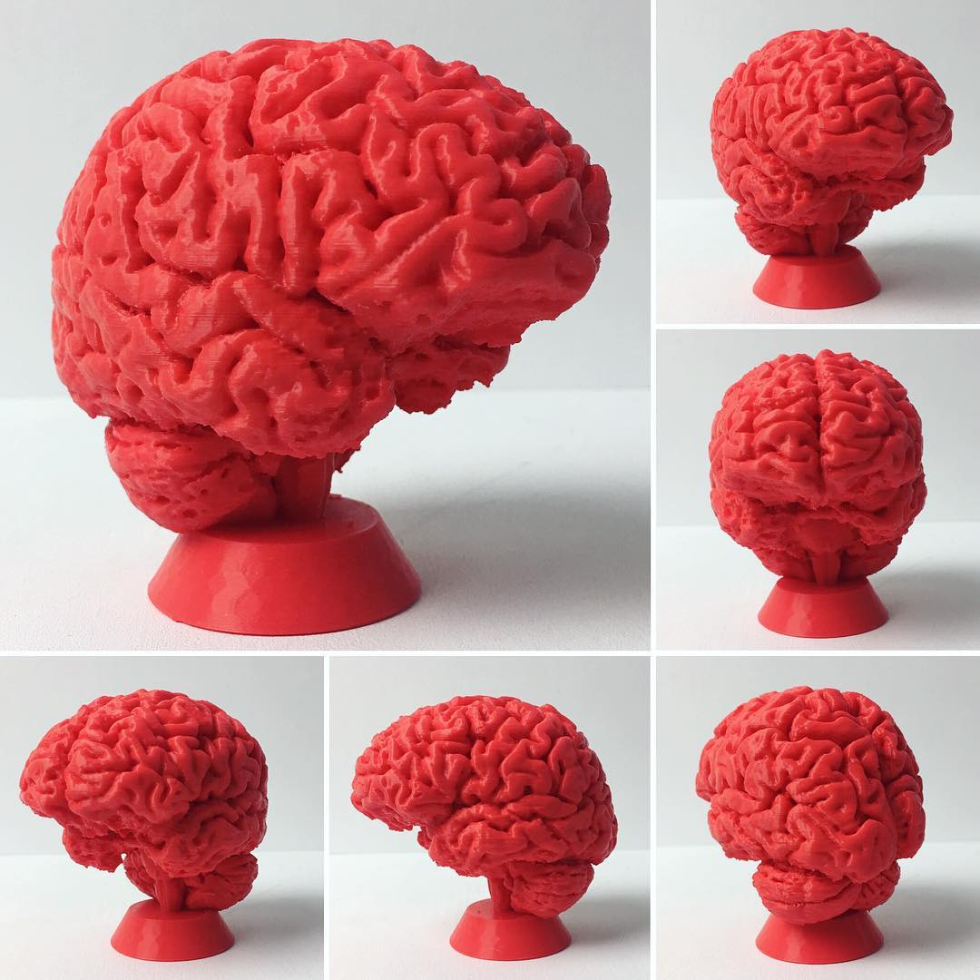 3D Printable Human Brain by Vaclav Krmela