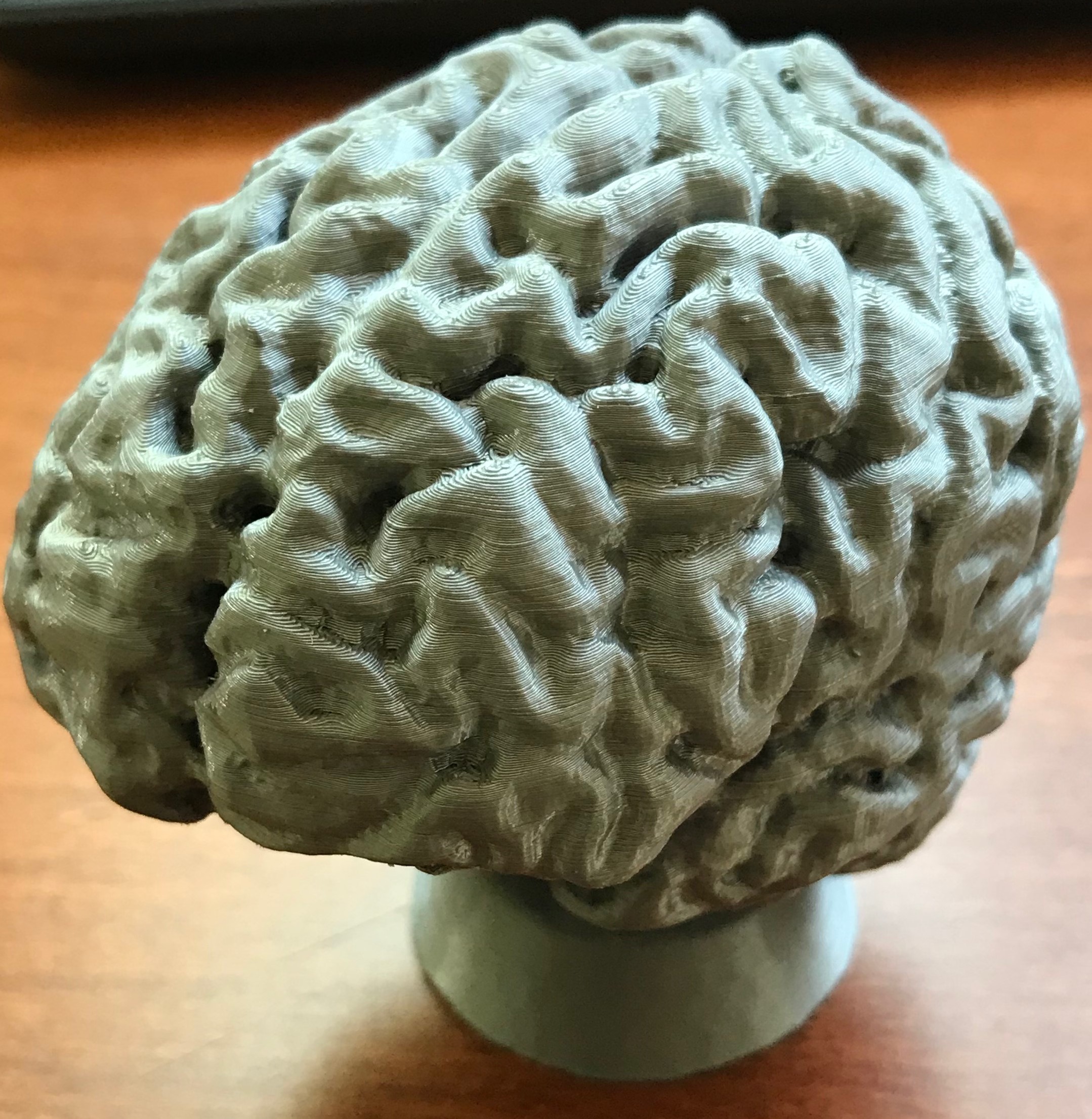 3D Printable Human Brain by Vaclav Krmela