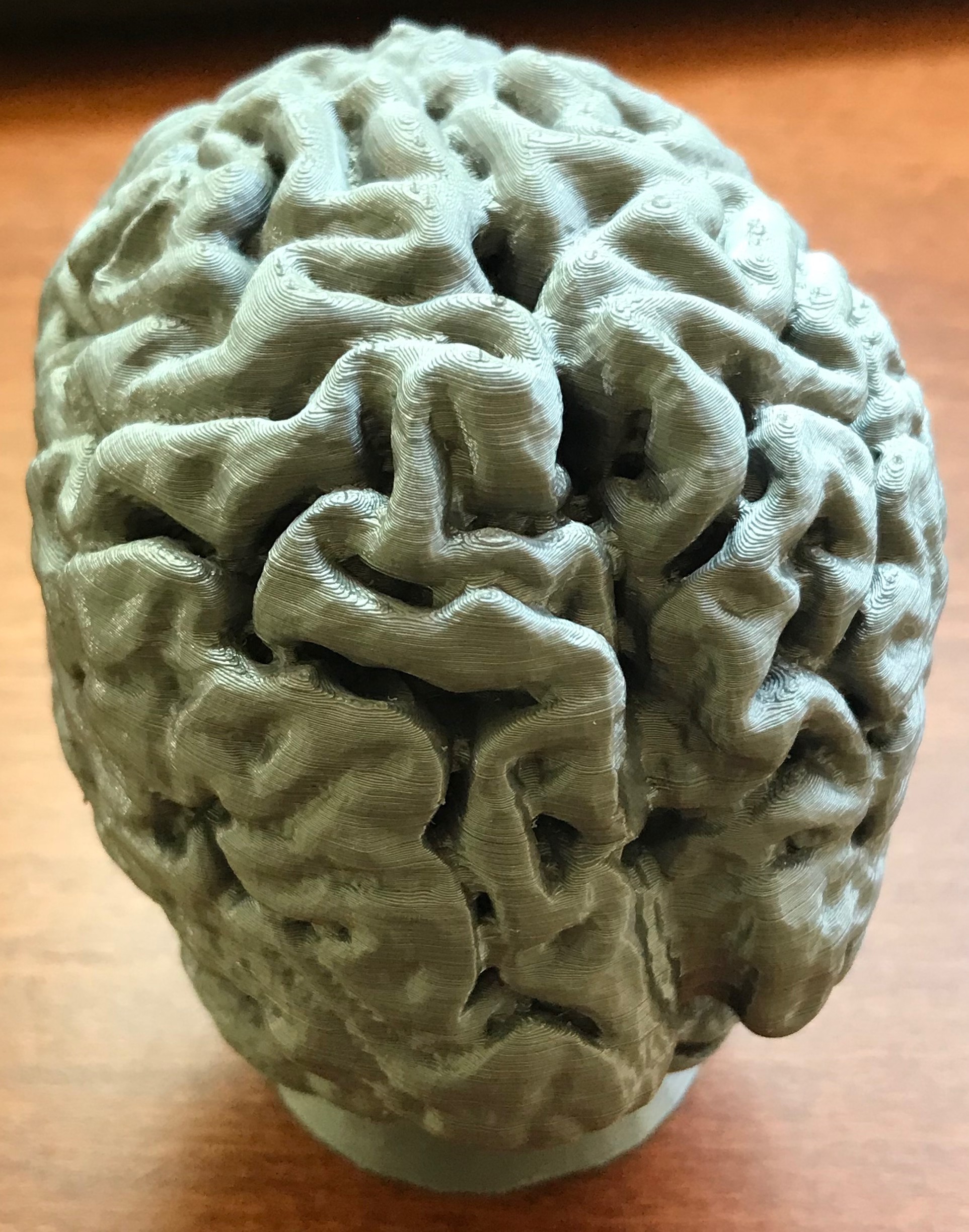 3D Printable Human Brain by Vaclav Krmela