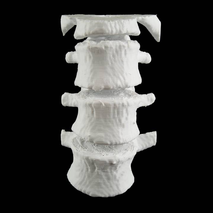 3D Printable Vertebral Column by ALFREDO ESPINOZA