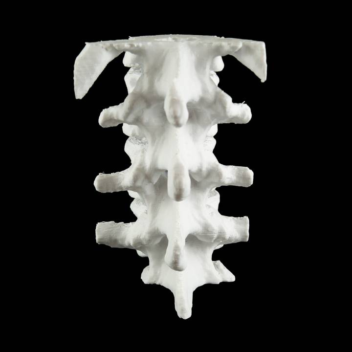3D Printable Vertebral Column by ALFREDO ESPINOZA