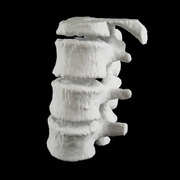 3D Printable Vertebral Column by ALFREDO ESPINOZA