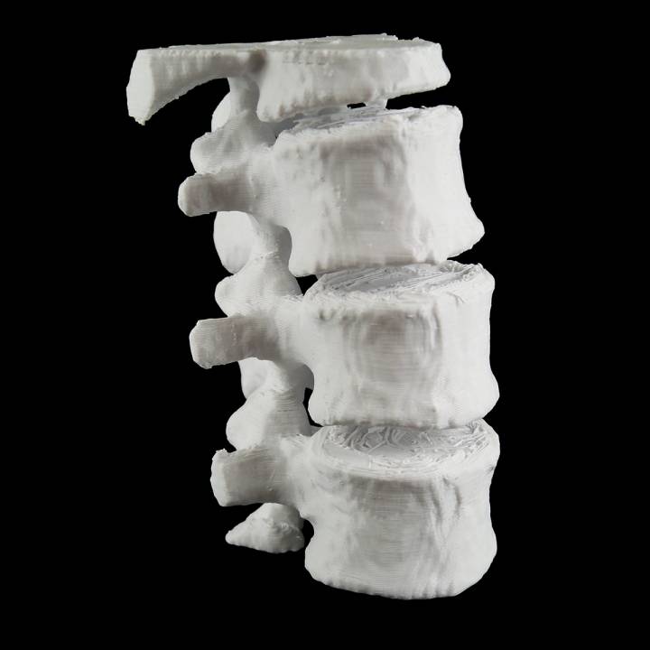 3D Printable Vertebral Column by ALFREDO ESPINOZA