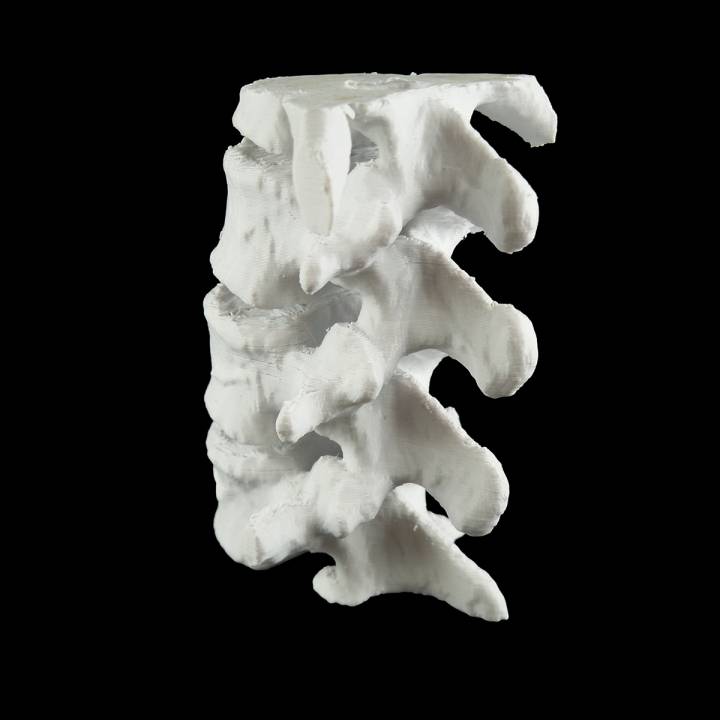 3D Printable Vertebral Column by ALFREDO ESPINOZA