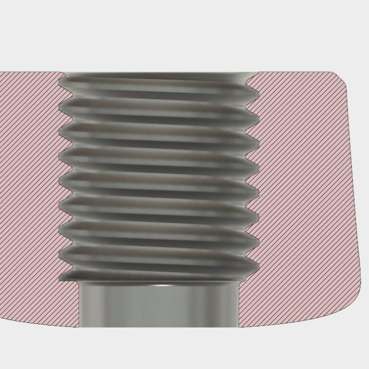 3D Printable Threaded PINDA Probe Protector by Christian Anker Kulmus