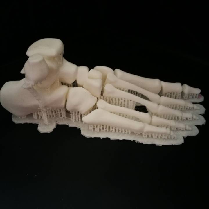 3D Printable Anatomical Model_Foot by William D'Ambrosio