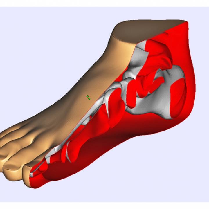 3D Printable Anatomical Model_Foot by William D'Ambrosio