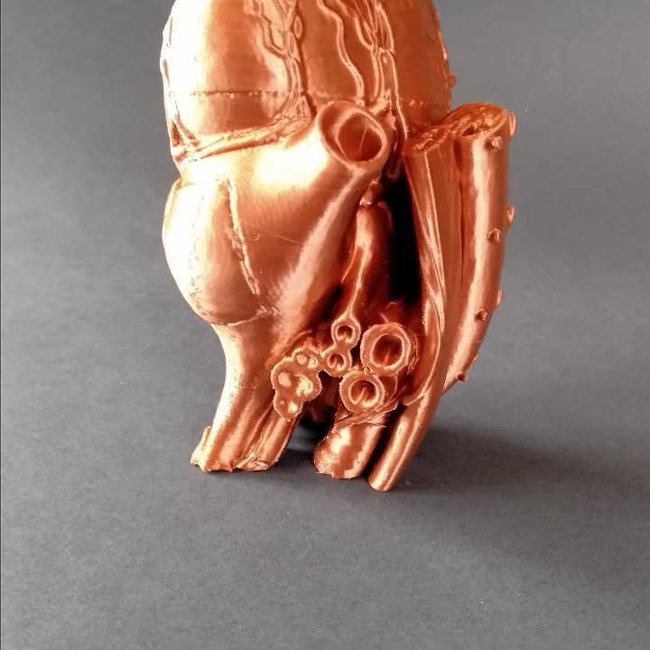 3D Print of Anatomical Heart by PeterAbsenger