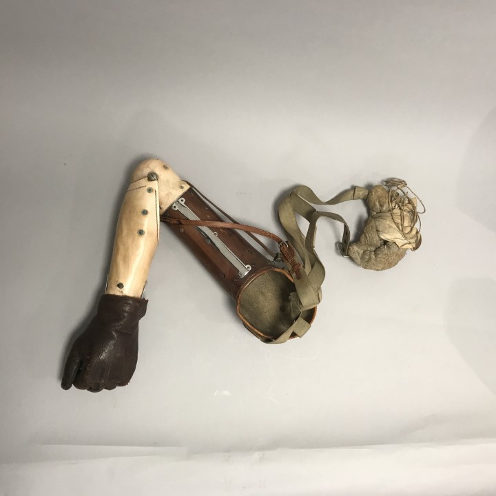 3D Printable Anatomical, prosthetic by Surgeon's Hall