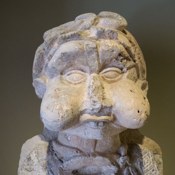 3D Printable Deformed Person by Scan The World