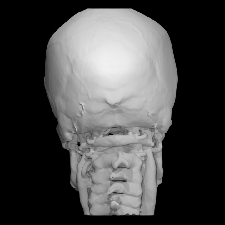 3D Printable Head by Scan The World