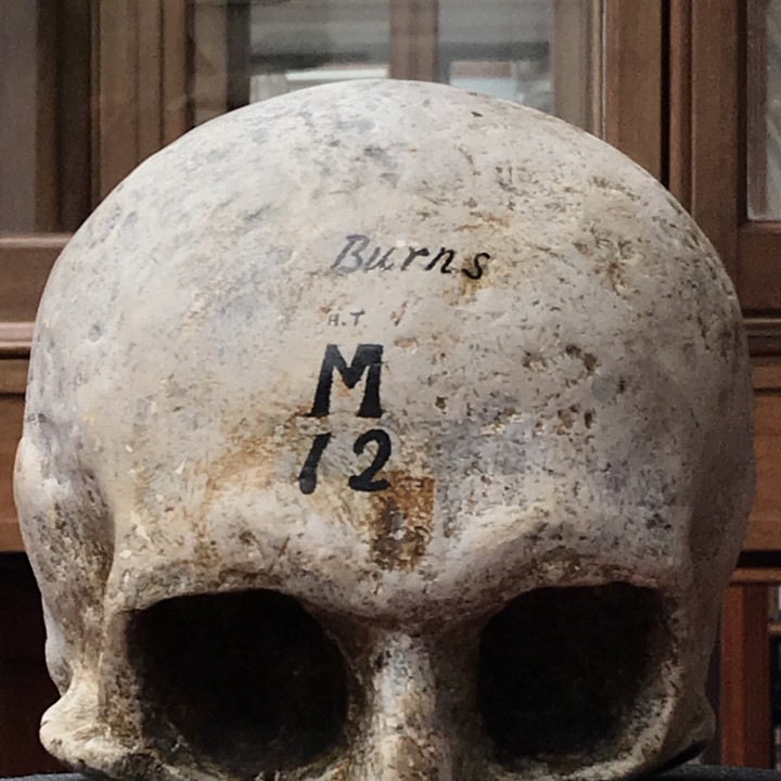 3D Printable Skull Cast of Robert Burns by Anatomical Museum