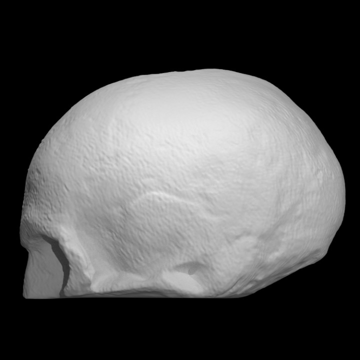 3D Printable Skull Cast of Robert Burns by Anatomical Museum