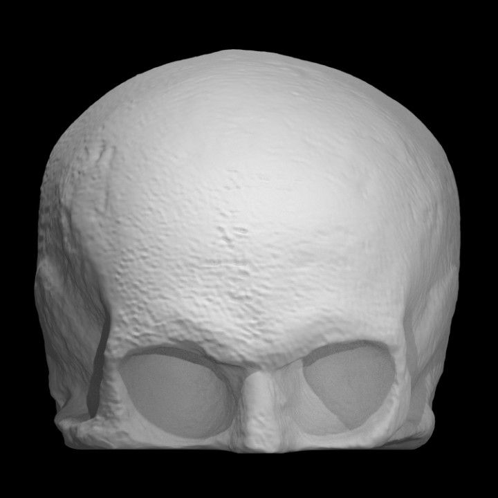 3D Printable Skull Cast of Robert Burns by Anatomical Museum