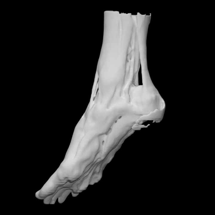 3D Printable Muscles of the foot and ankle by Scan The World