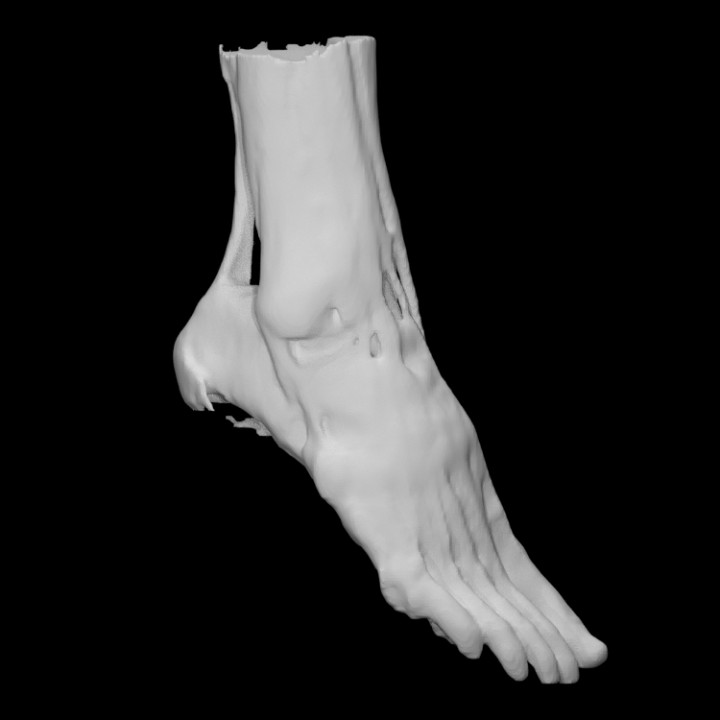 3D Printable Muscles of the foot and ankle by Scan The World