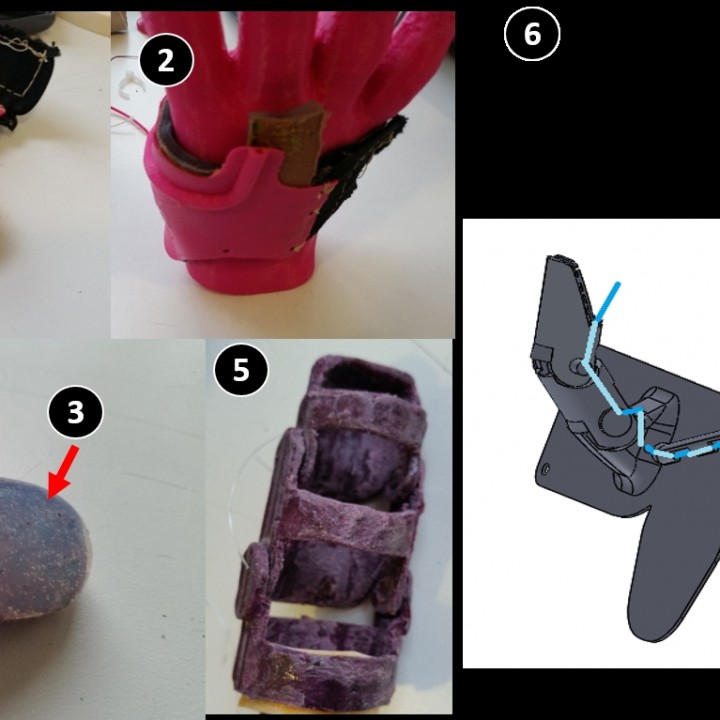 3D Printable Thumb Prosthesis by Gabriela Alejandra Bravo Illanes
