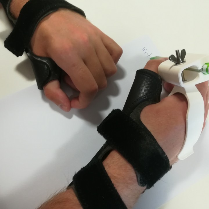 3D Printable Metacarpal splint by Matthias Van De Walle