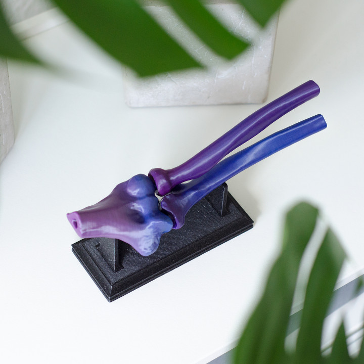 3D Printable Elbow Joint from CT-Scans by Andreas Mass