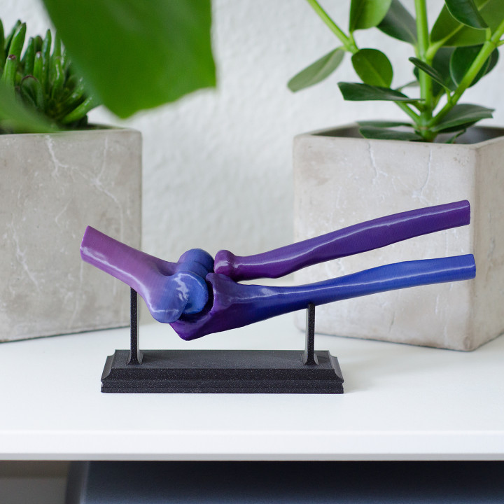 3D Printable Elbow Joint from CT-Scans by Andreas Mass