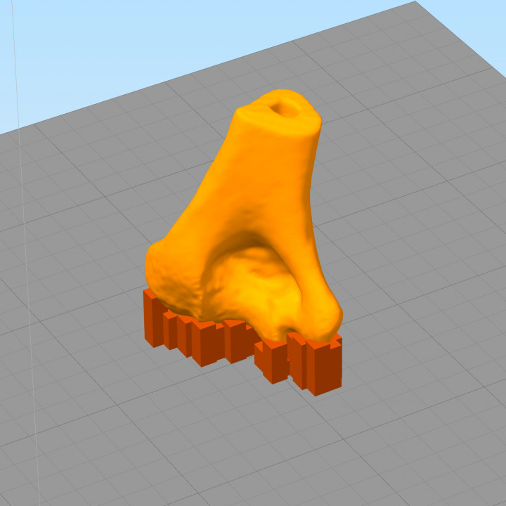 3D Printable Elbow Joint from CT-Scans by Andreas Mass