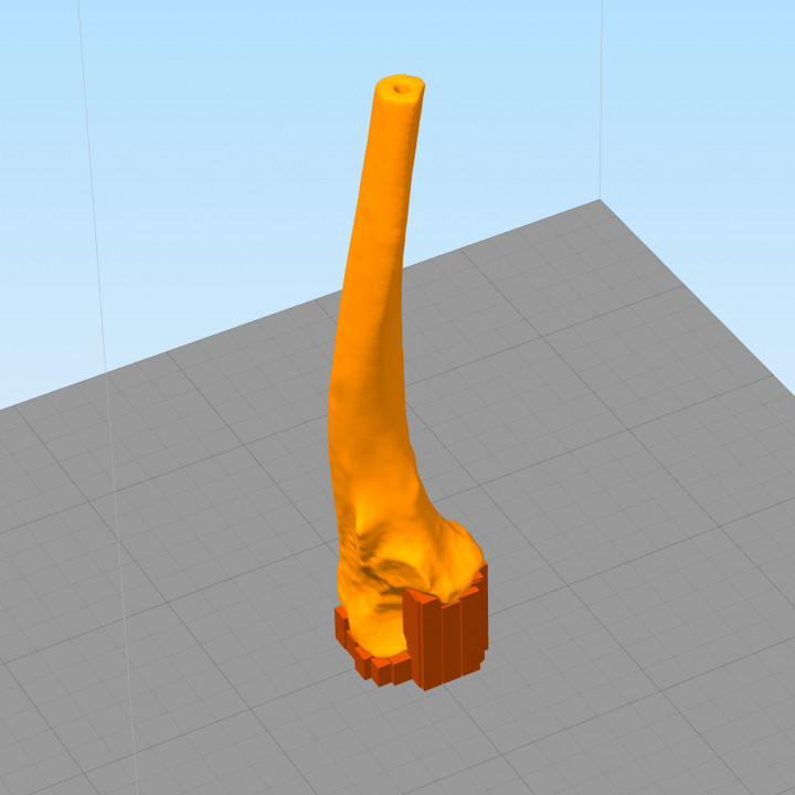 3D Printable Elbow Joint from CT-Scans by Andreas Mass