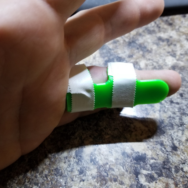 3D Printable Finger Splint by Joe Prints