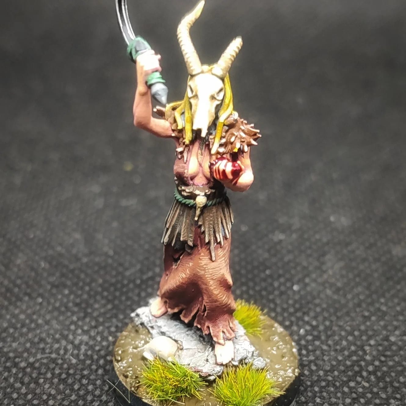 3D Printable Blight Druid (Presupported Reworked) by GloomyKidMinis