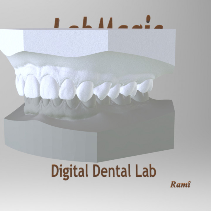 3D Printable Digital Orthodontic Study Models with Virtual Bases by ...