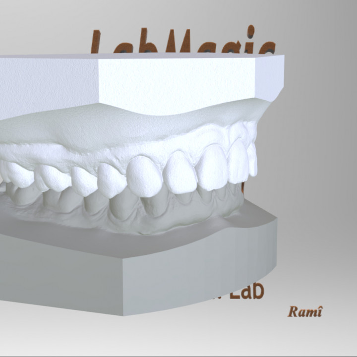 3D Printable Digital Orthodontic Study Models with Virtual Bases by ...