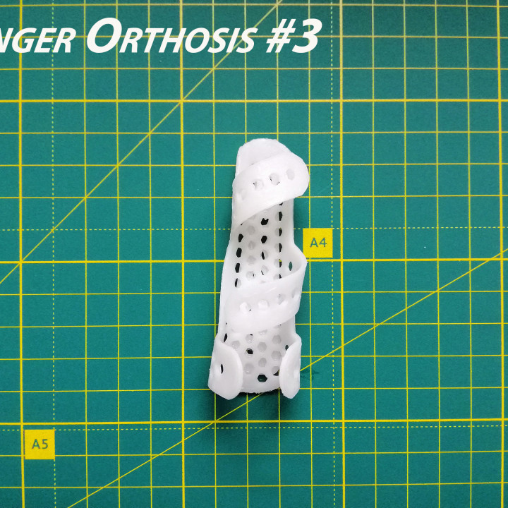3D Printable Finger orthosis by Oleksandr